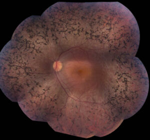 Électro­­physiologie - Osiris Vision